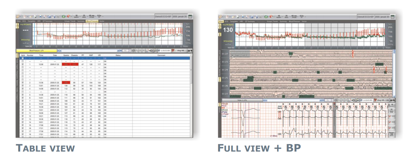 EC-3H/ABP COMBINED HOLTER SYSTEM – Delta Plus Pvt